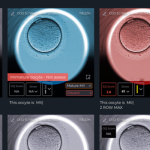 Best Fertility Clinic in London: Avenues | AI-Powered IVF ...